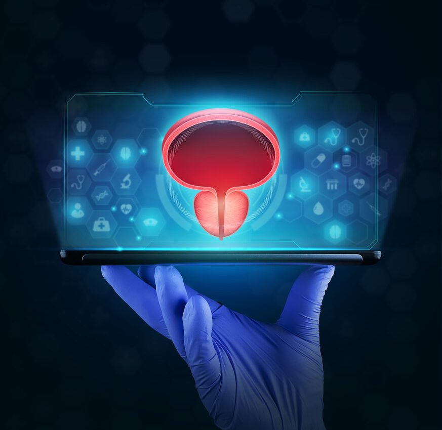 Qual a melhor opção de cirurgia a laser para próstatas de grande volume ...